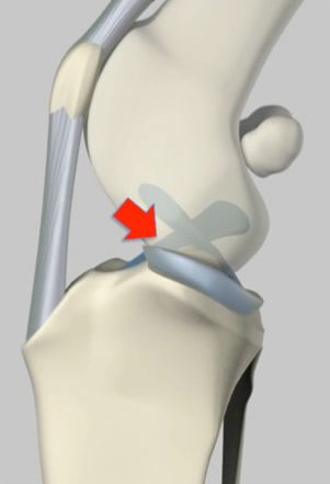 Cruciate MMP surgery | Pet Advice Bicester